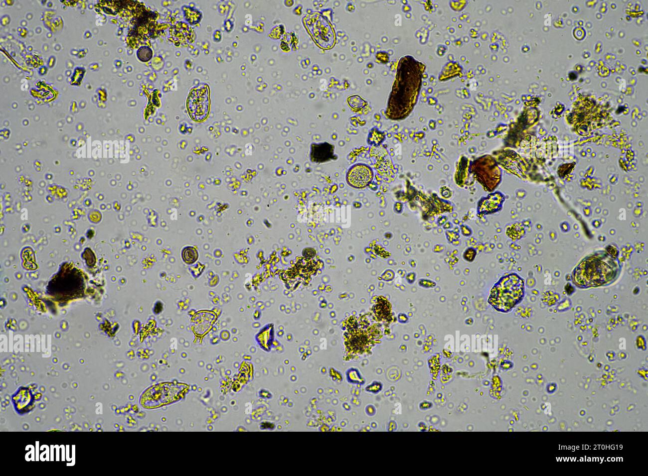 Microorganisms and biology in Compost and soil sample under the ...