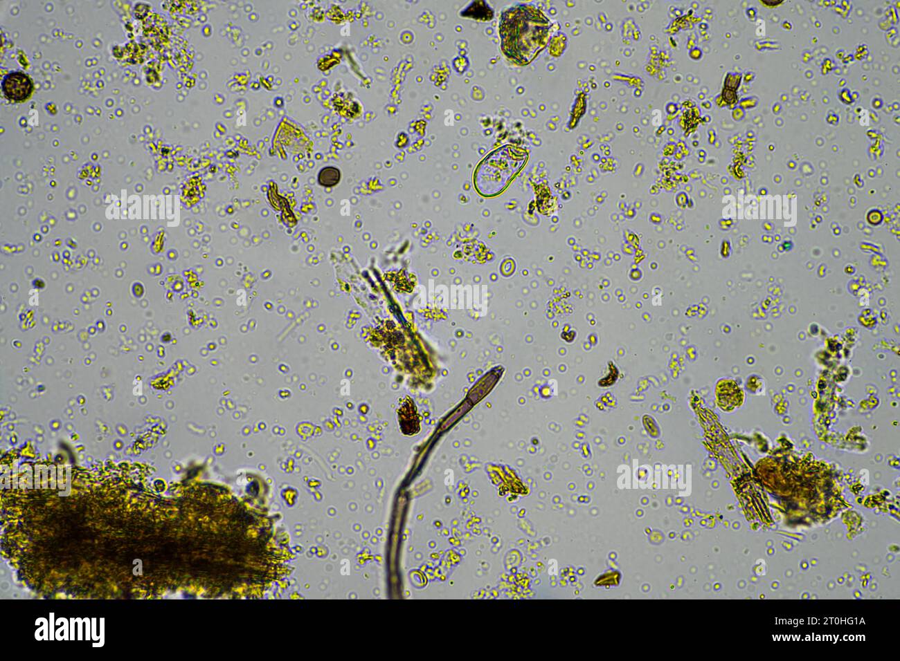 Microorganisms and biology in Compost and soil sample under the ...