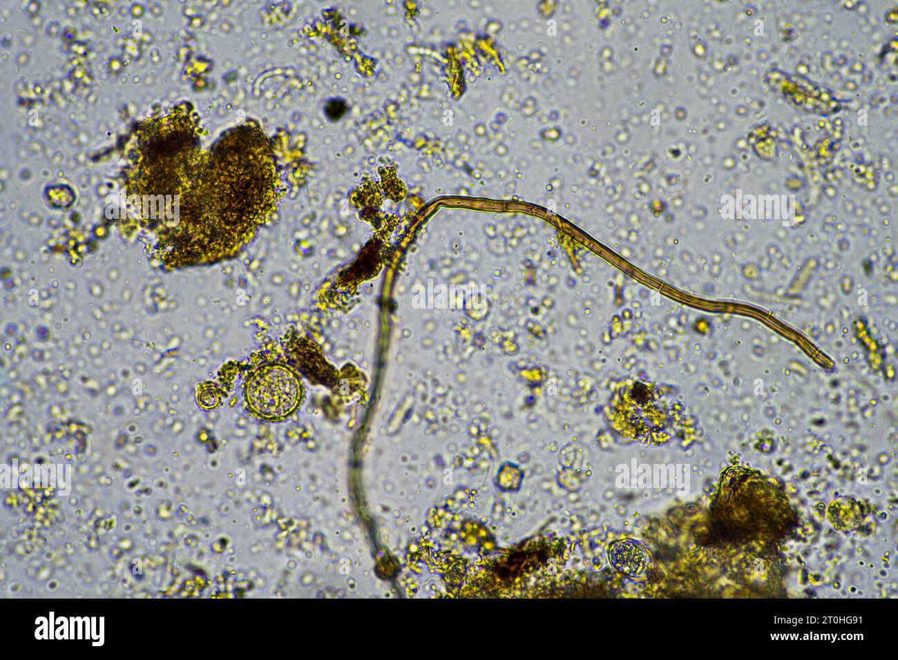 Microorganisms and biology in Compost and soil sample under the ...