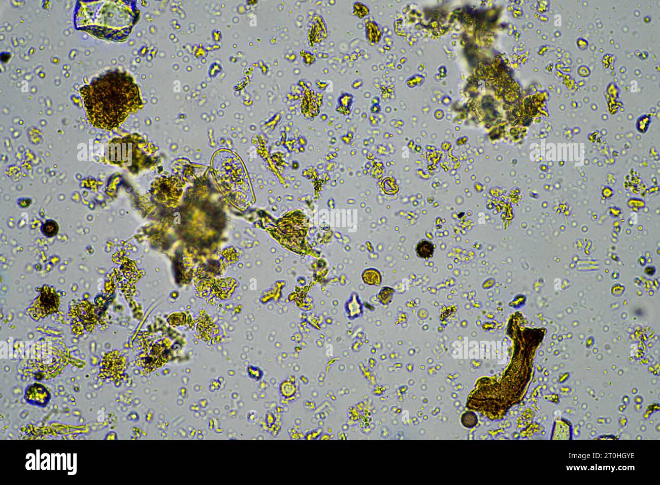 Microorganisms and biology in Compost and soil sample under the ...