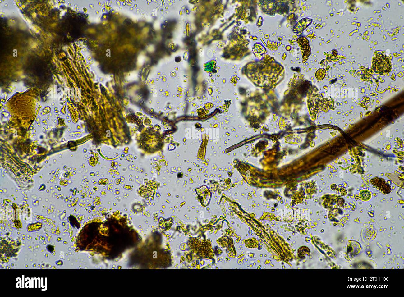 Microorganisms and biology in Compost and soil sample under the ...