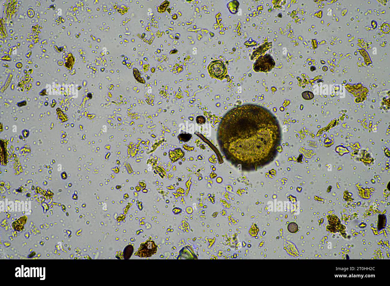 Microorganisms and biology in Compost and soil sample under the ...