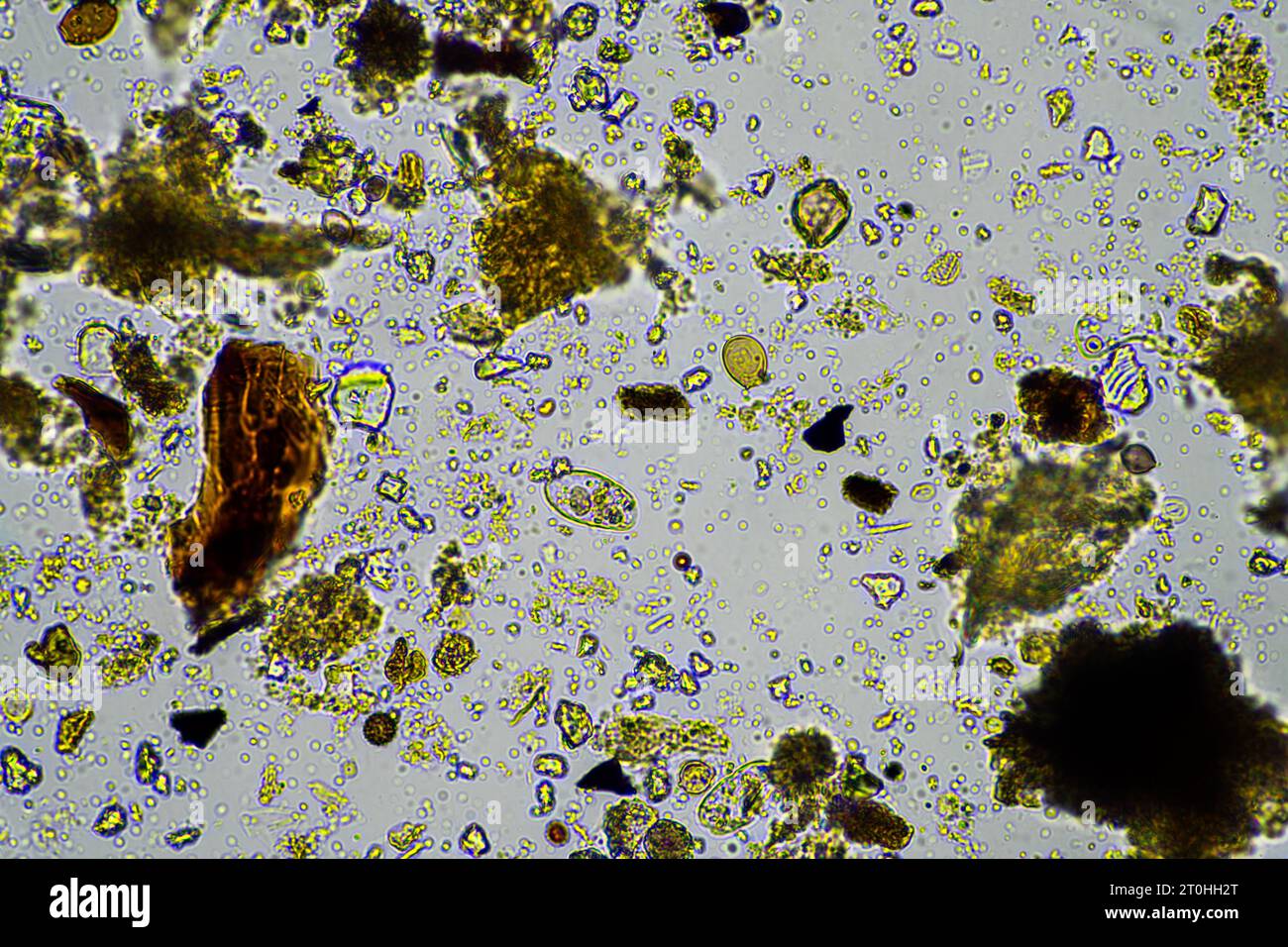 Microorganisms and biology in Compost and soil sample under the ...