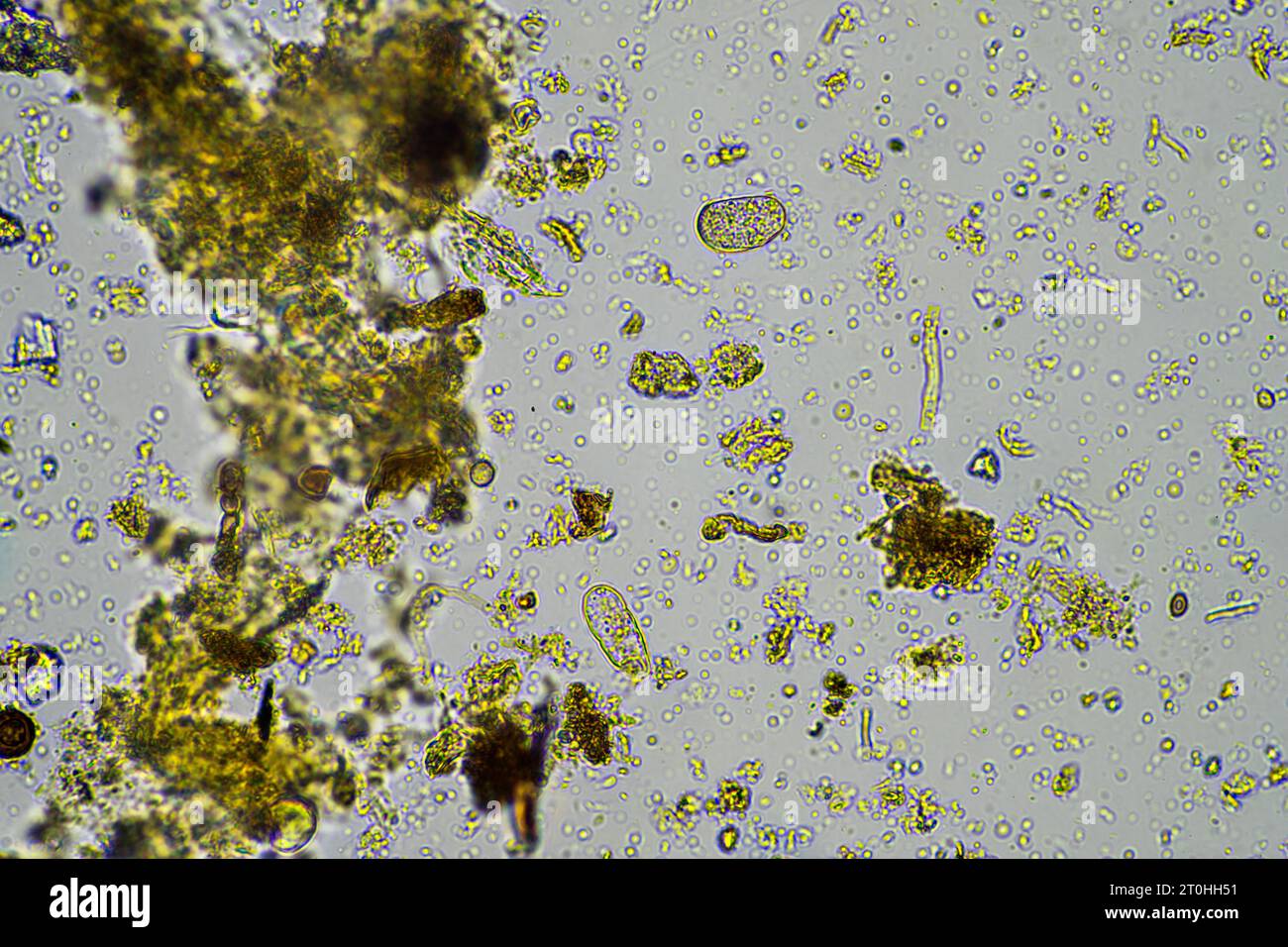 Microorganisms and biology in Compost and soil sample under the ...