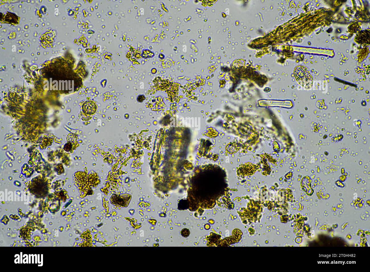 Microorganisms and biology in Compost and soil sample under the ...