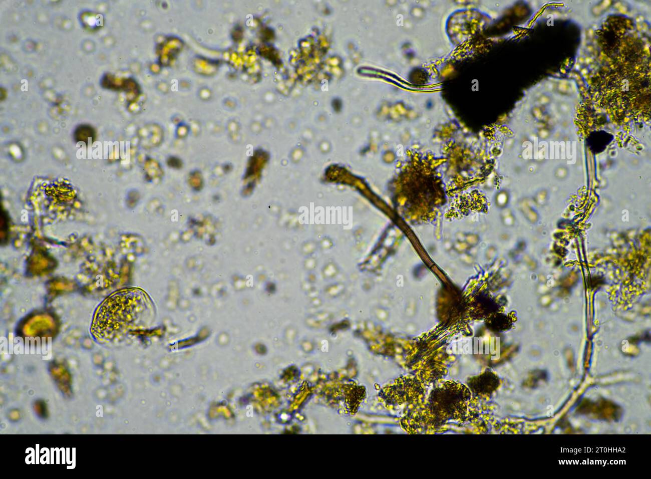 Microorganisms and biology in Compost and soil sample under the ...