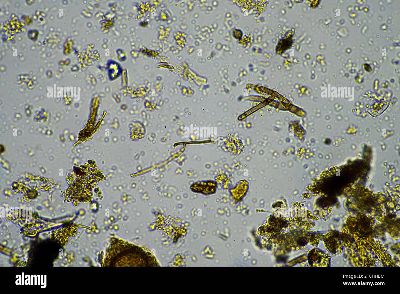 Microorganisms and biology in Compost and soil sample under the ...