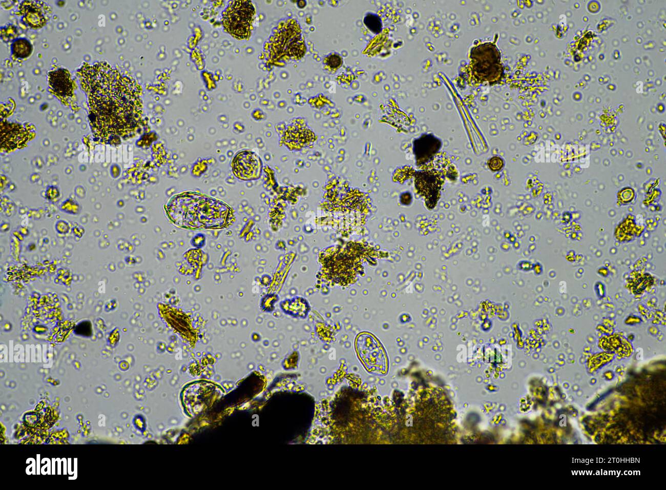 Microorganisms and biology in Compost and soil sample under the ...