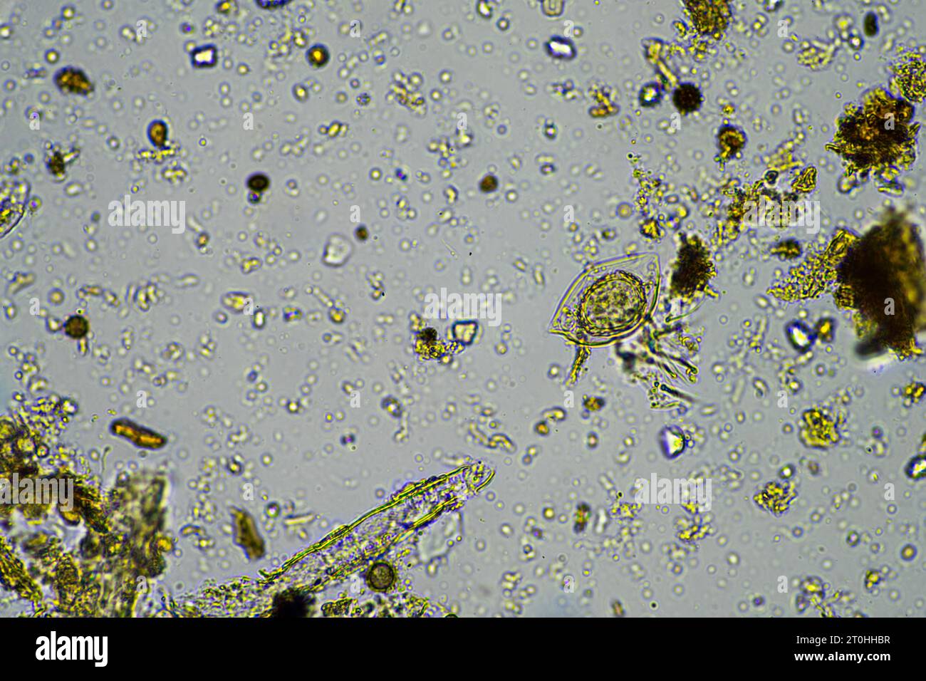 Microorganisms and biology in Compost and soil sample under the ...