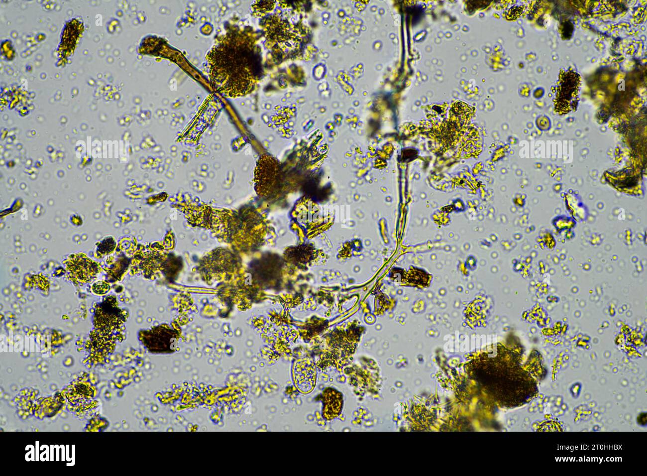 Microorganisms and biology in Compost and soil sample under the ...