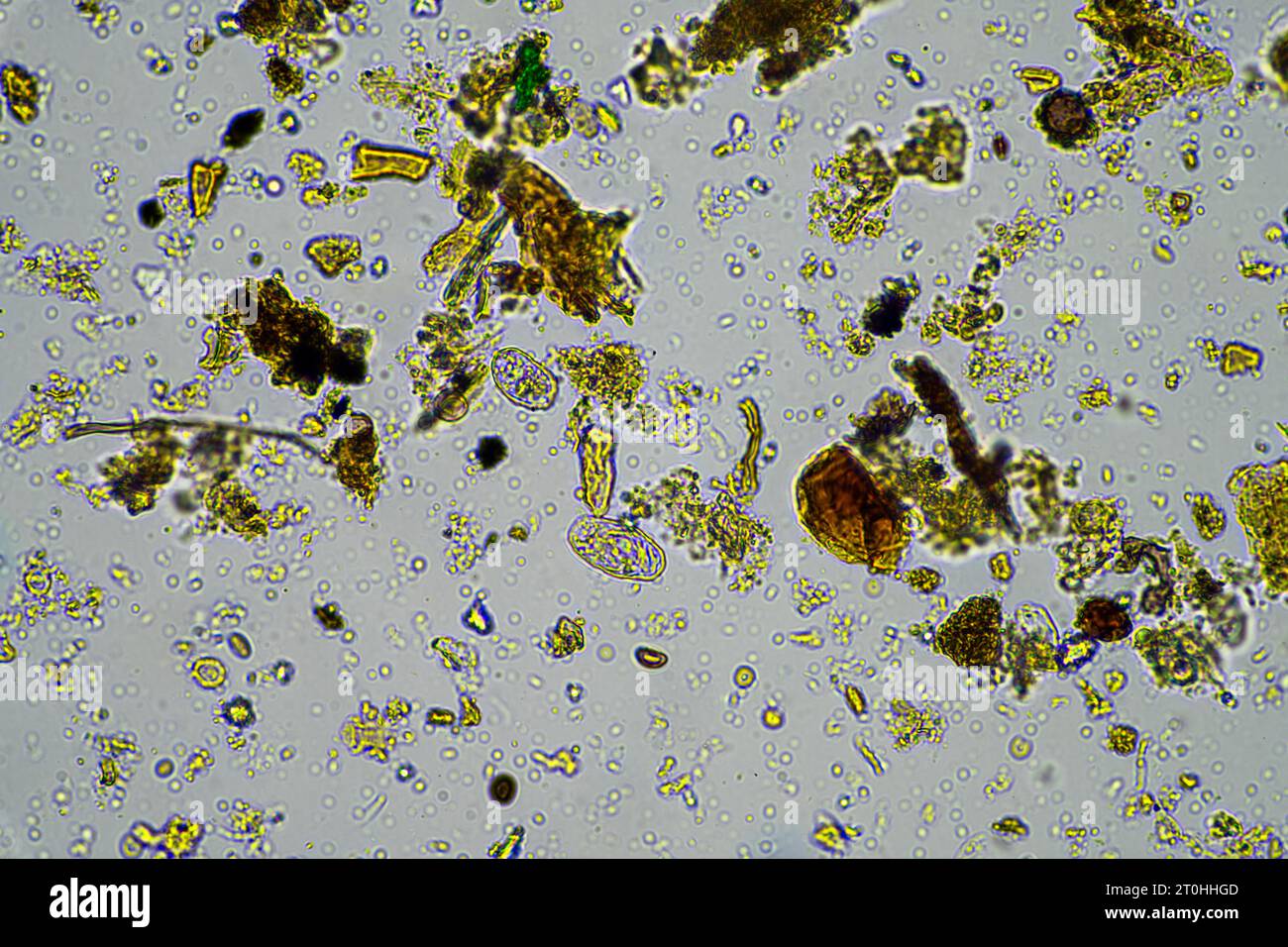 Microorganisms and biology in Compost and soil sample under the ...