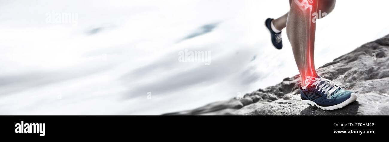 Banner, runner and training with injury on leg for anatomy for joint ...