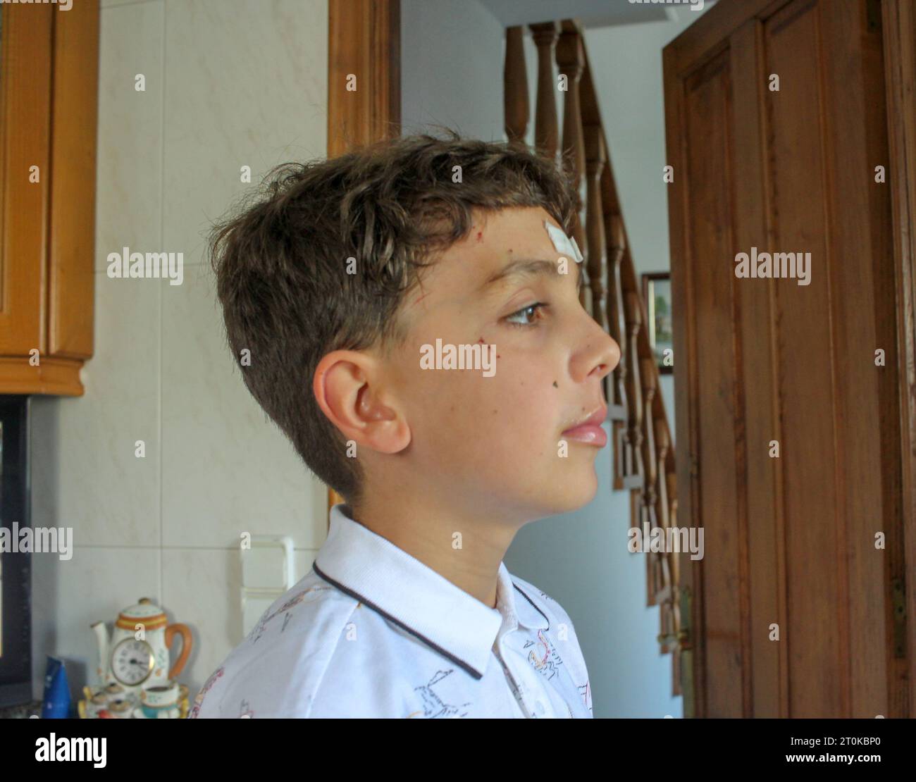 young boy with bruises in his forehead and adhesive bandage Stock Photo ...