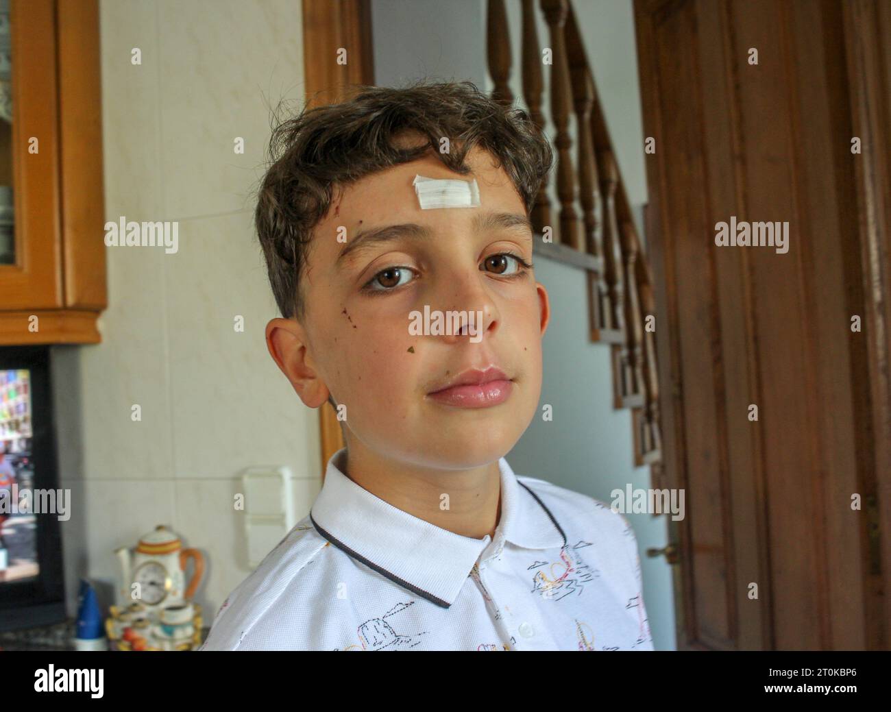 my son with bruises in his face and an adhesive bandage Stock Photo - Alamy