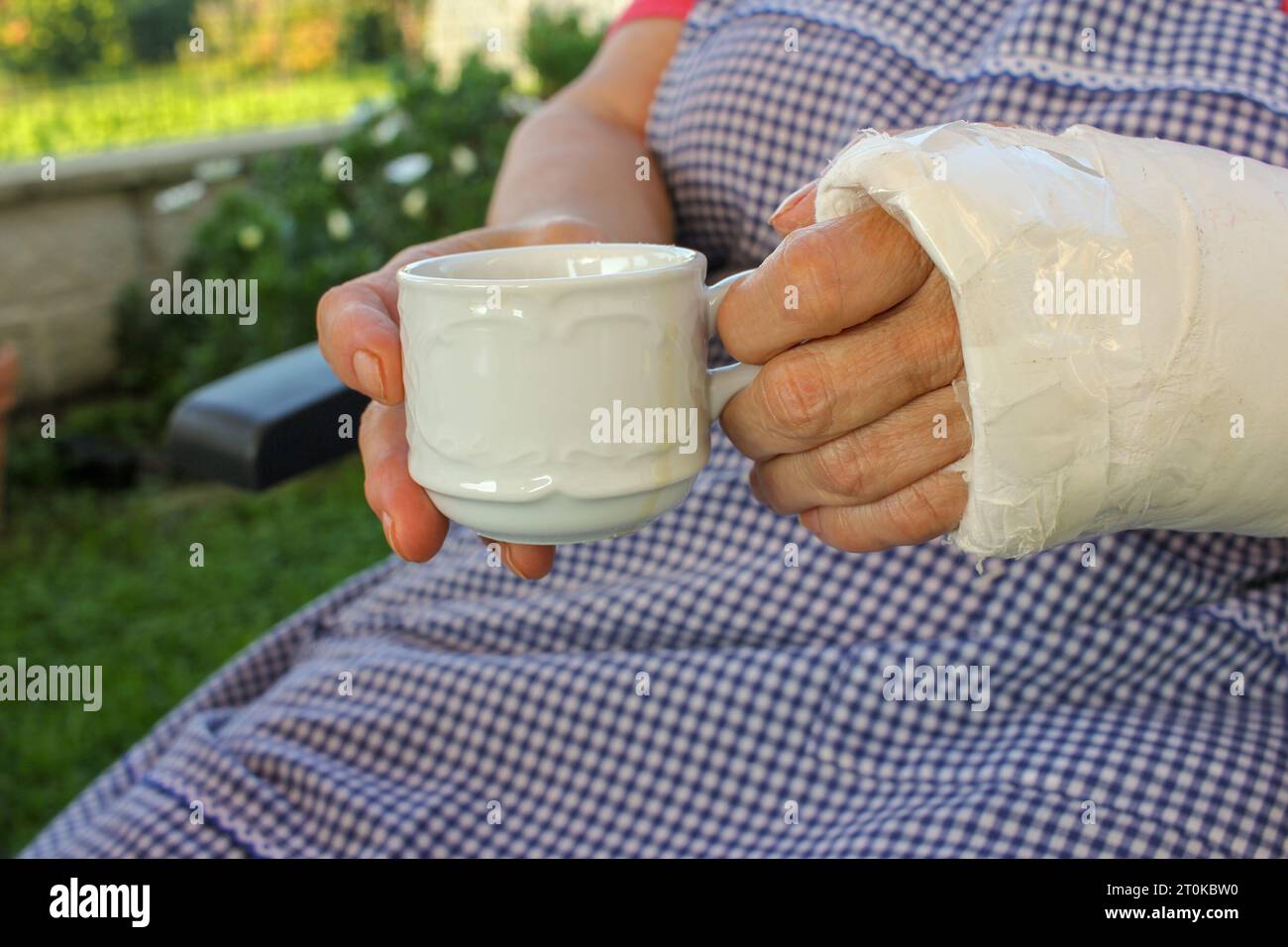 Woman arm cast hi-res stock photography and images - Alamy