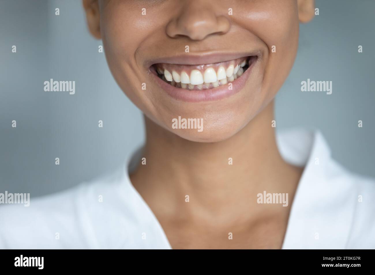 Close up of biracial woman show white healthy teeth Stock Photo - Alamy