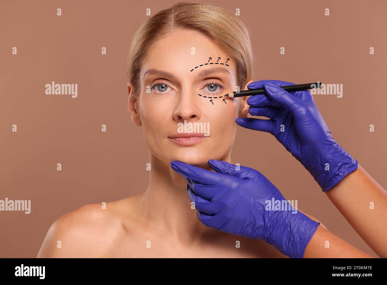 Woman preparing for cosmetic surgery, light brown background. Doctor ...