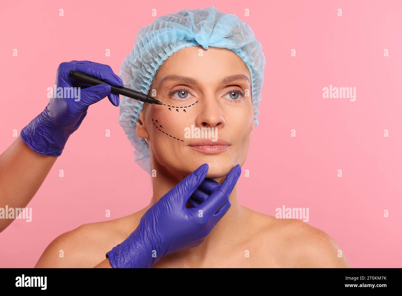 Woman preparing for cosmetic surgery, pink background. Doctor drawing ...