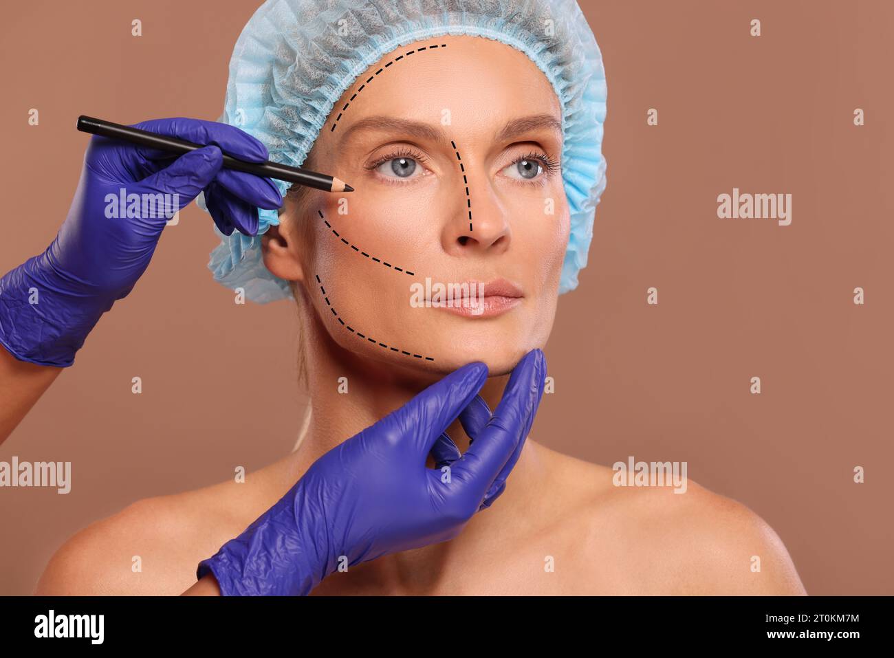 Woman preparing for cosmetic surgery, light brown background. Doctor ...