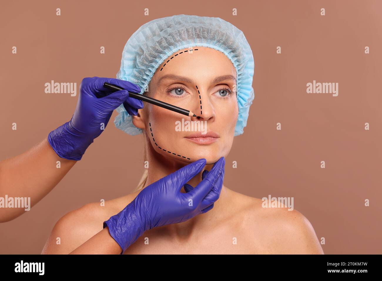 Woman preparing for cosmetic surgery, light brown background. Doctor ...