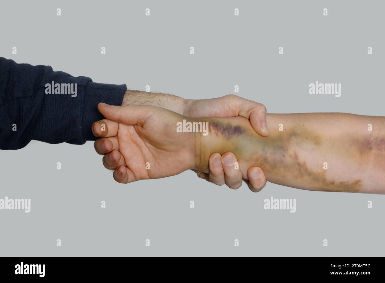 Domestic violence portrait abused hurt hi-res stock photography and ...