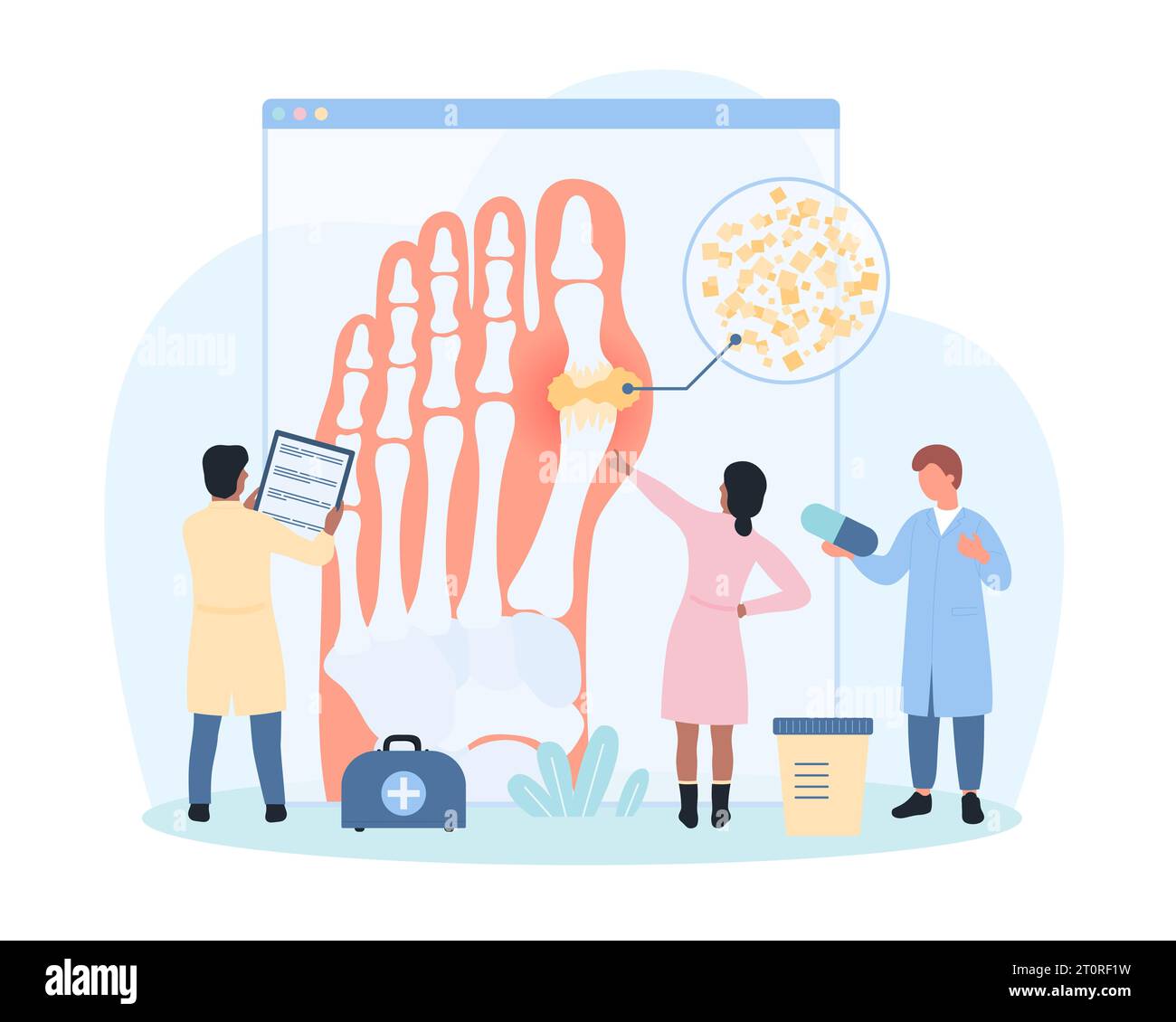 Diagnosis of gout vector illustration. Cartoon tiny people study ...