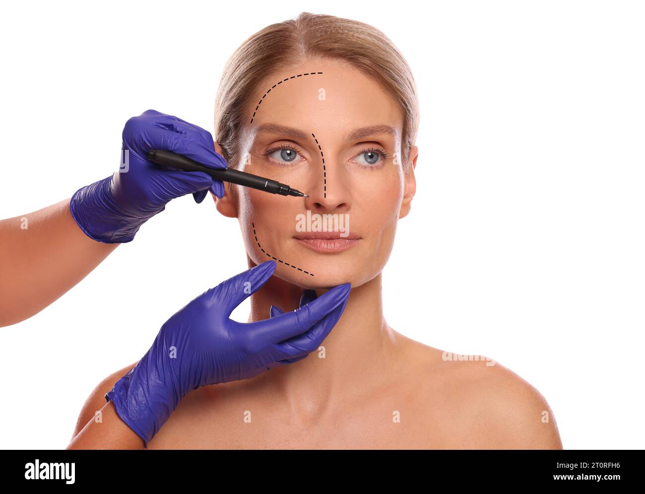 Woman preparing for cosmetic surgery, white background. Doctor drawing ...