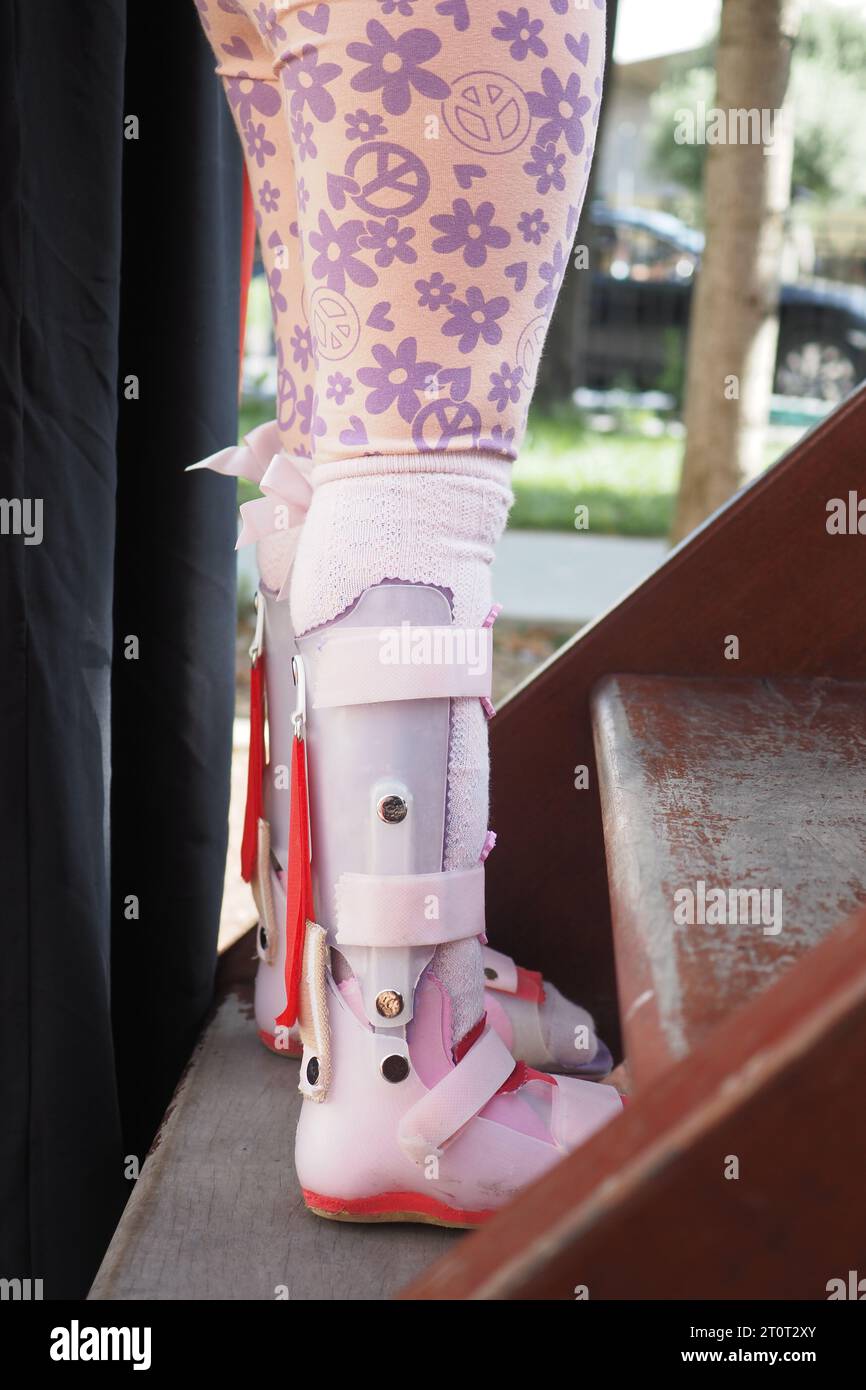 Child cerebral palsy disability, legs orthosis Stock Photo - Alamy