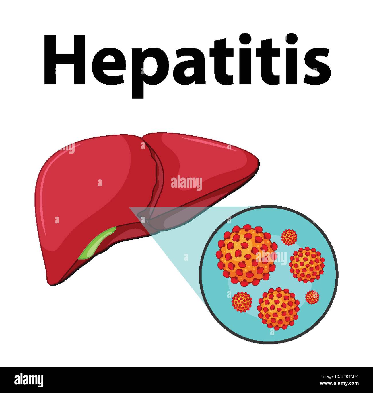 Detailed Illustration Of Hepatitis Virus Cell On Human Liver Stock Vector Image And Art Alamy