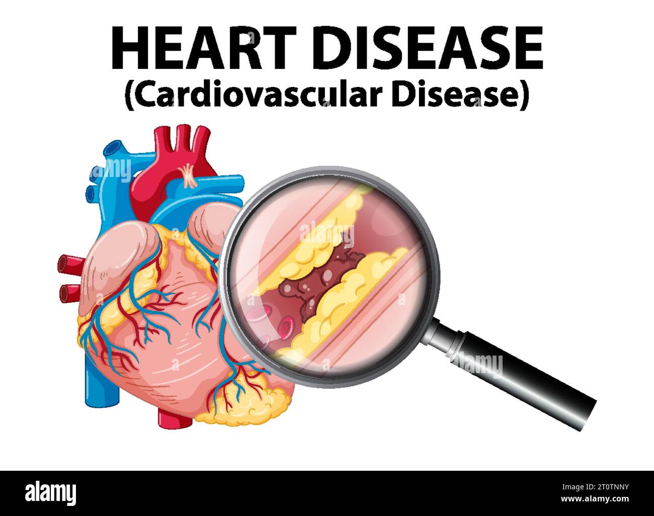 Illustration depicting sickness and heart disease in a medical ...