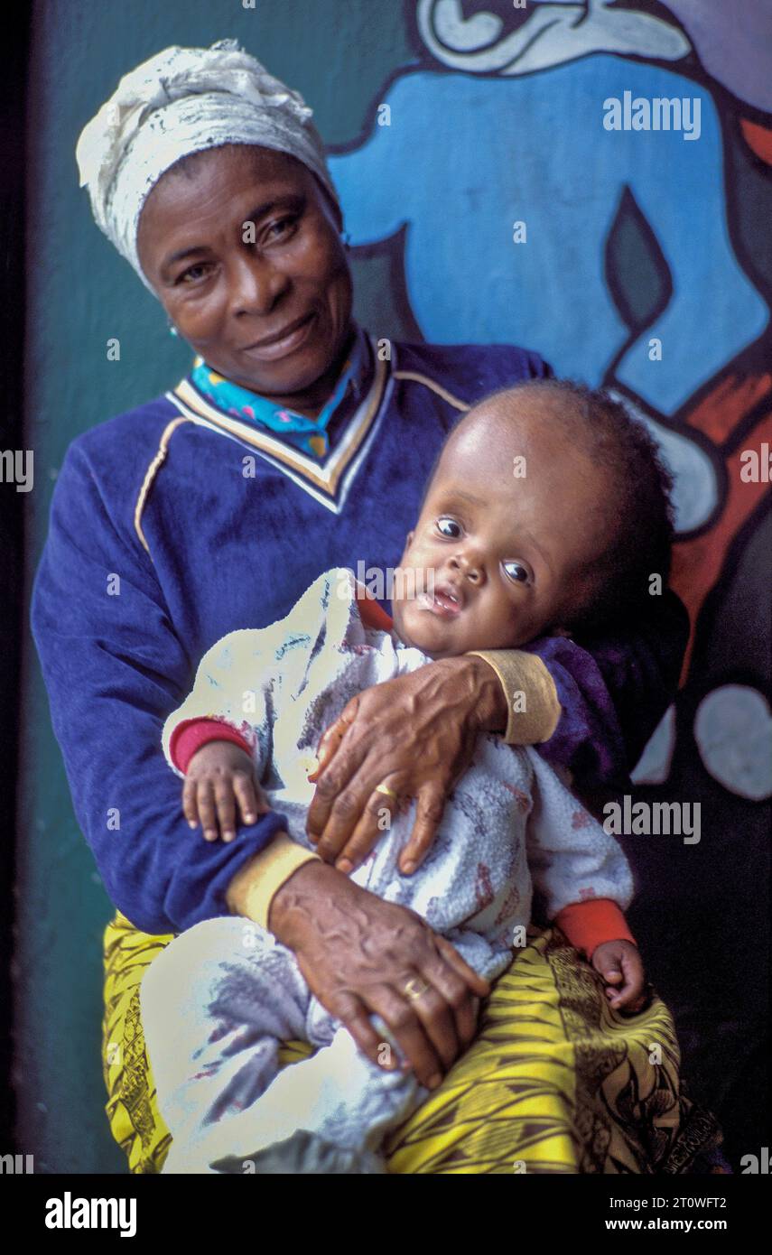 Hydrocephalus and africa hi-res stock photography and images - Alamy
