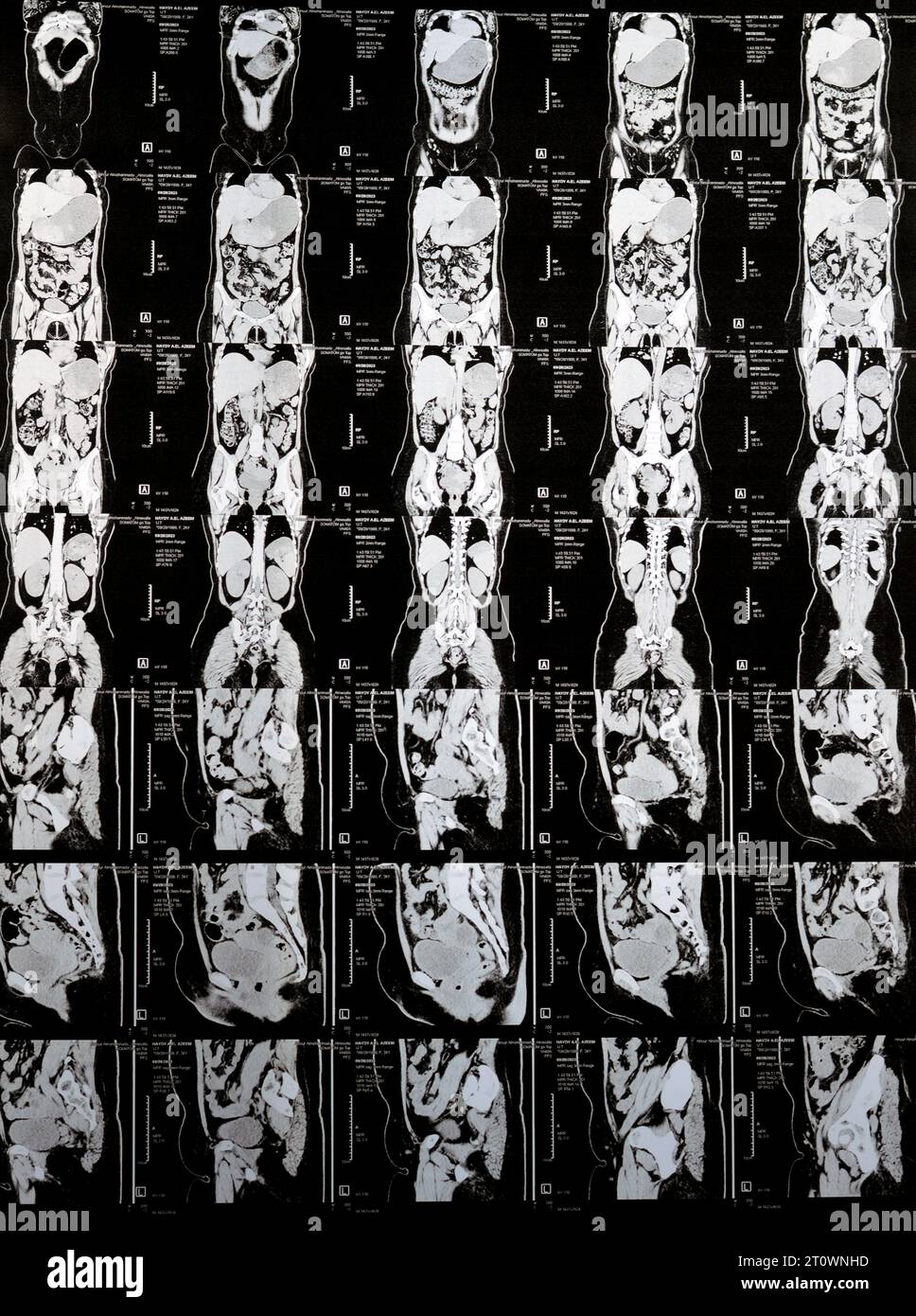 Cairo, Egypt, October 3 2023: Multi slice CT scan abdomen and pelvis ...