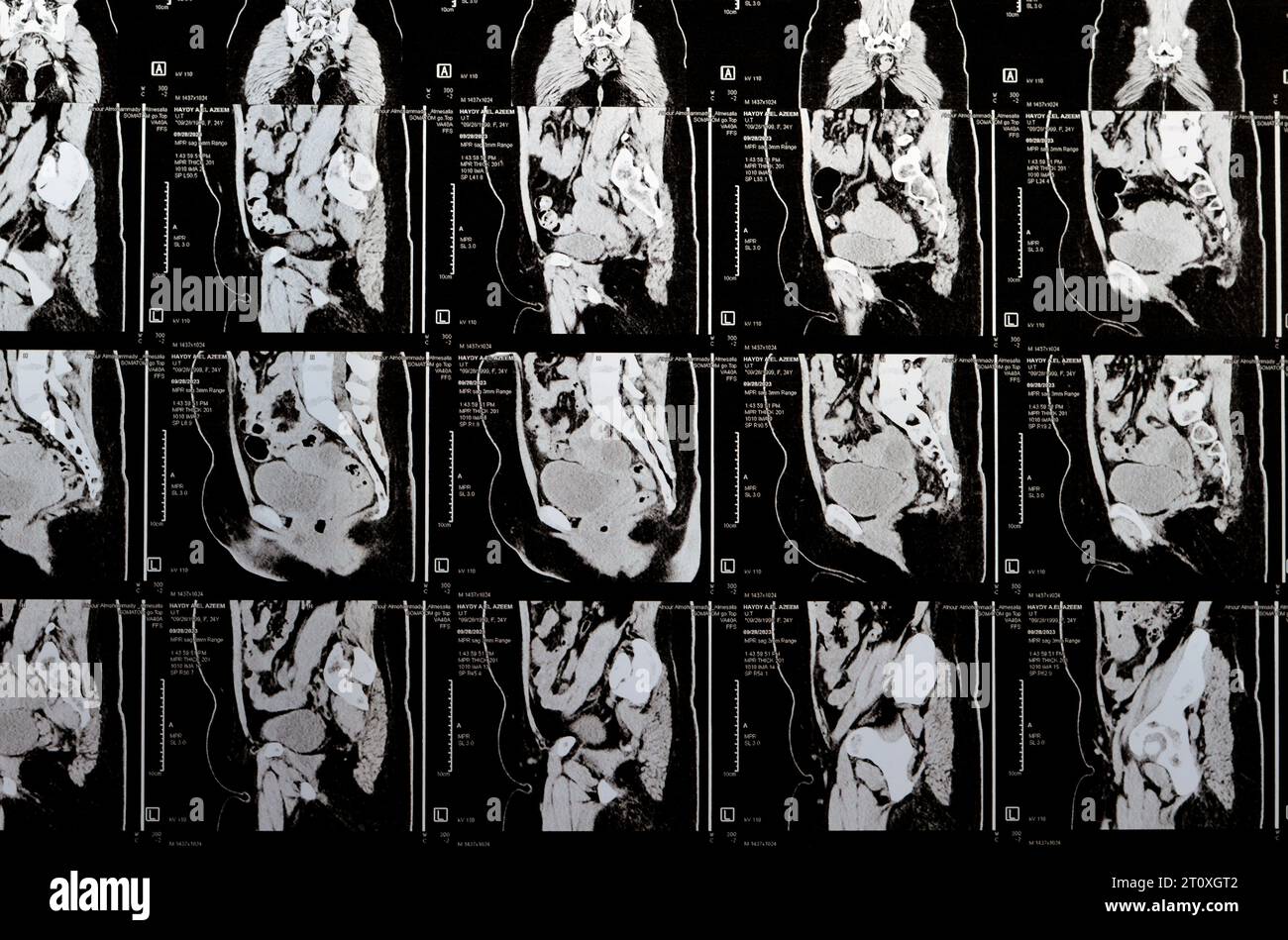 Cairo, Egypt, October 3 2023: Multi slice CT scan abdomen and pelvis ...