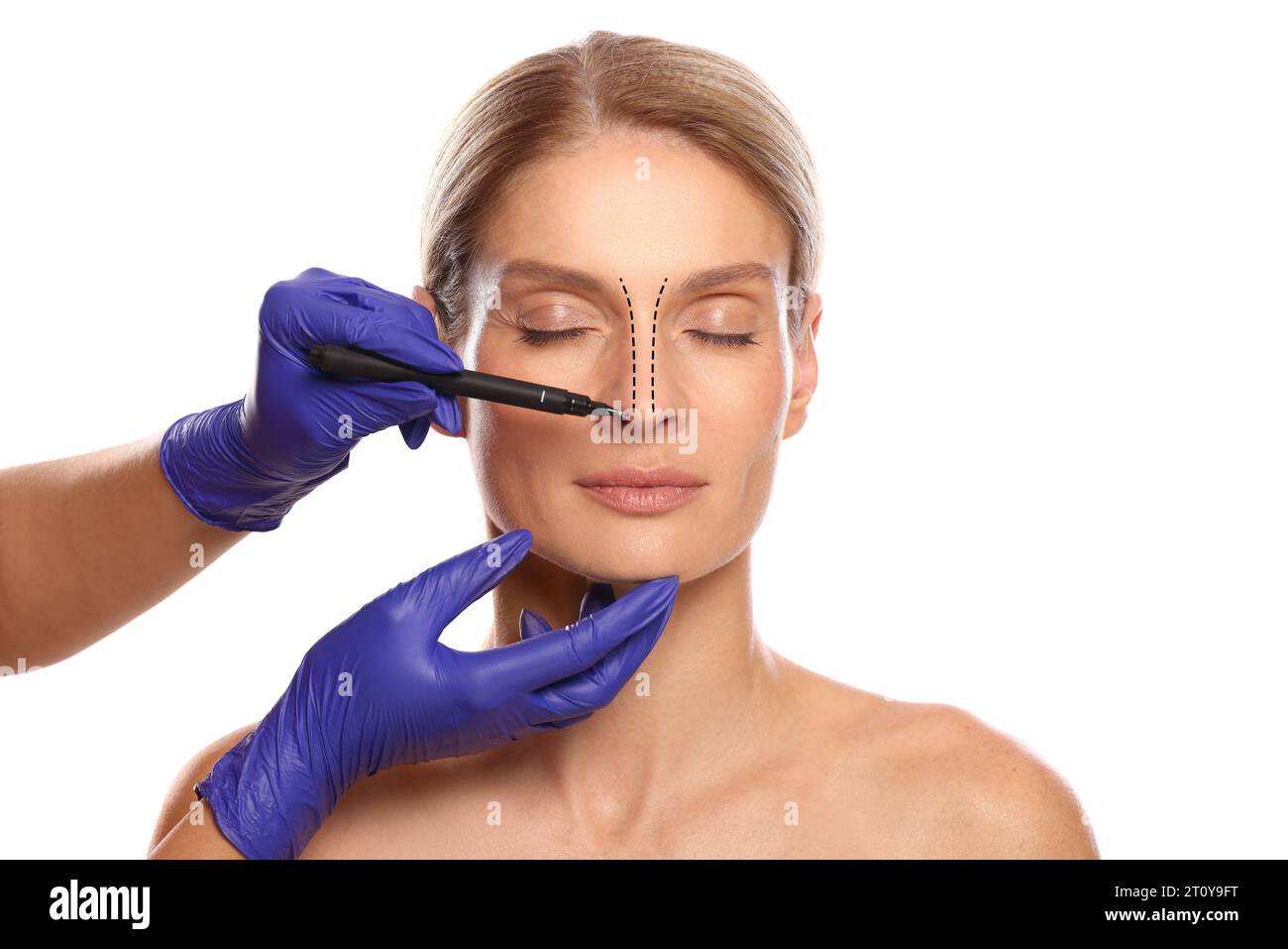 Woman preparing for cosmetic surgery, white background. Doctor drawing ...