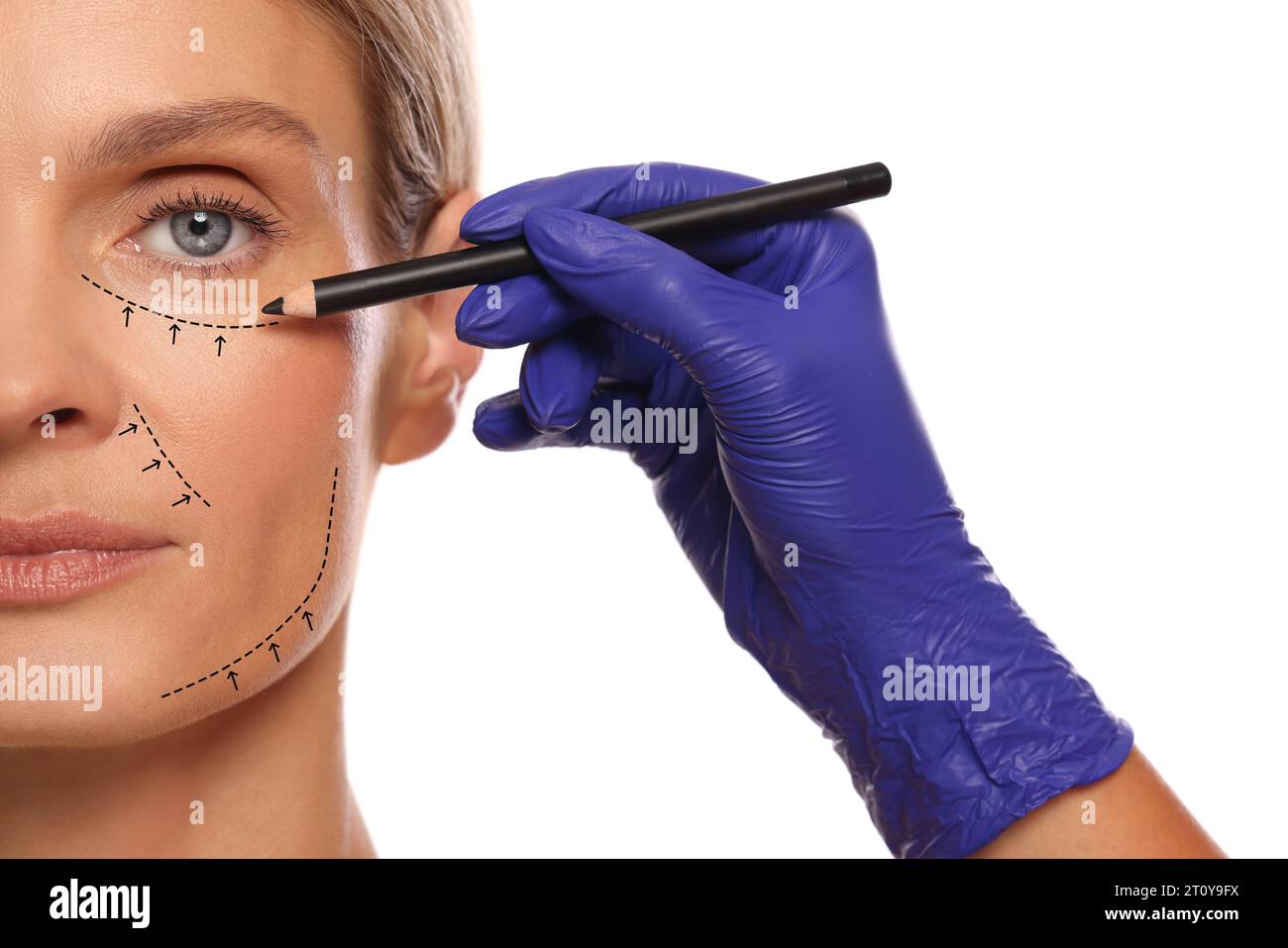 Woman preparing for cosmetic surgery, white background. Doctor drawing ...