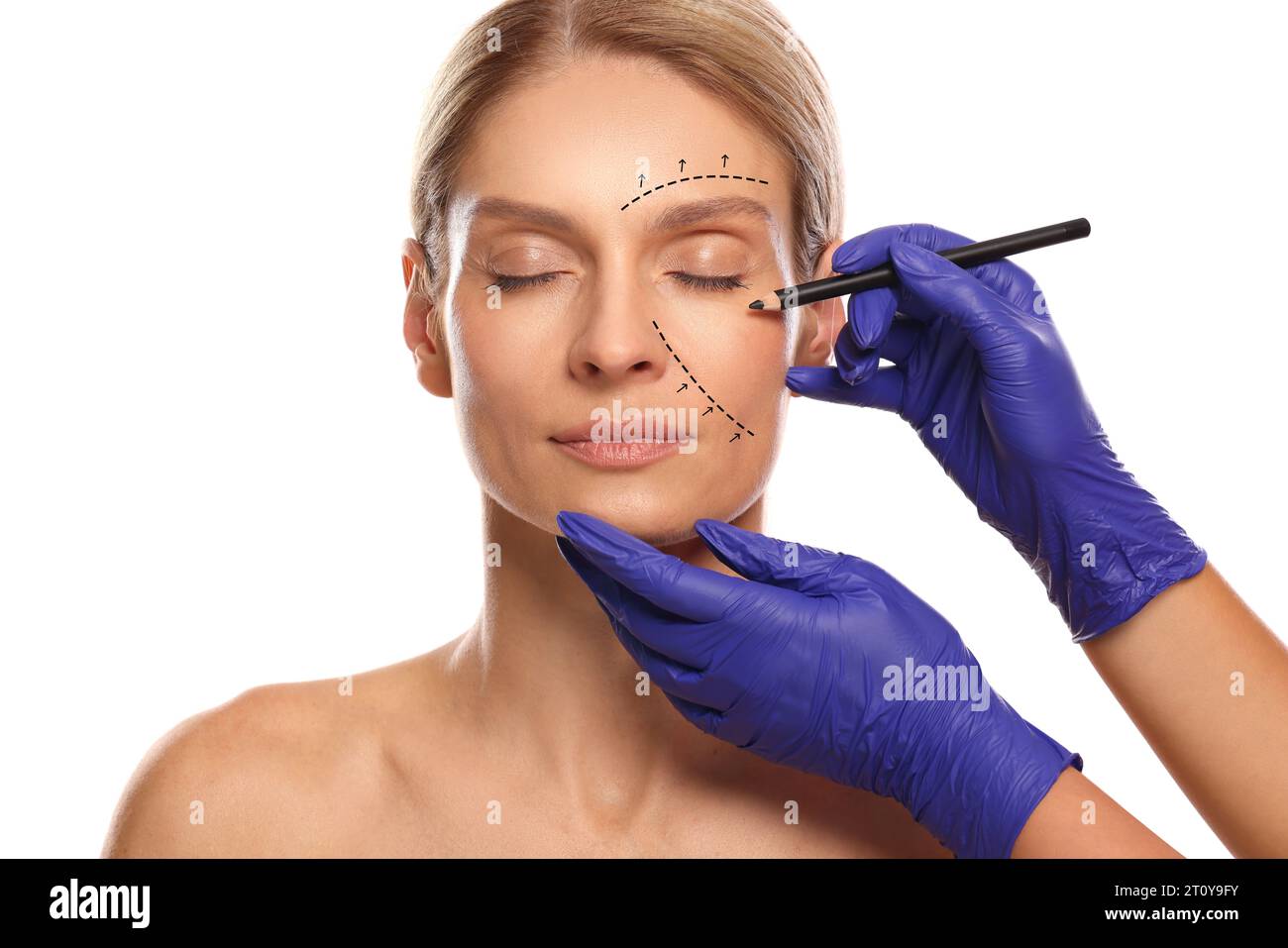 Woman preparing for cosmetic surgery, white background. Doctor drawing ...