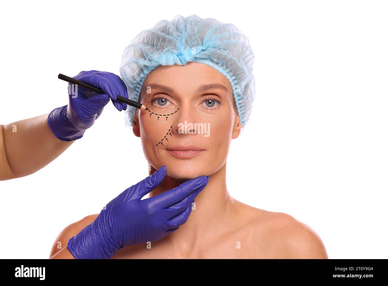 Woman preparing for cosmetic surgery, white background. Doctor drawing ...