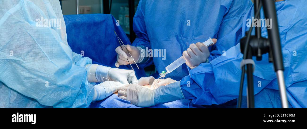 Hands of doctors and nurses in sterile gloves perform a surgical ...