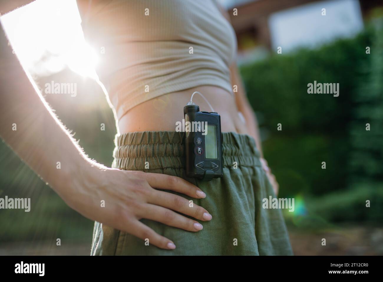 Close up of diabetic woman with insulin pump. Young woman with diabetes ...