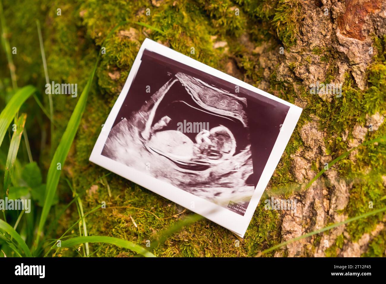 An echo of a baby on a tree, pregnant session in a forest Stock Photo ...
