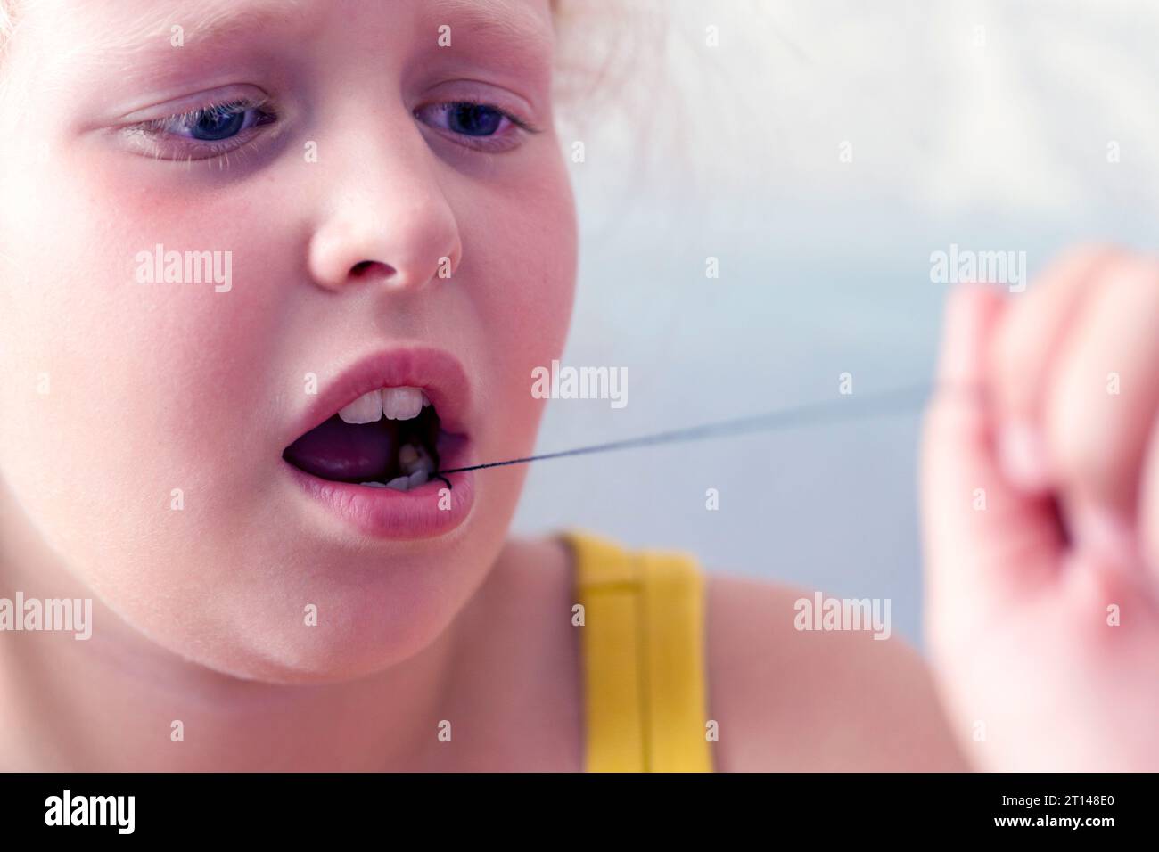 Girl Holds Thread To Pull Out A Milk Tooth Removal Of Tooth At The