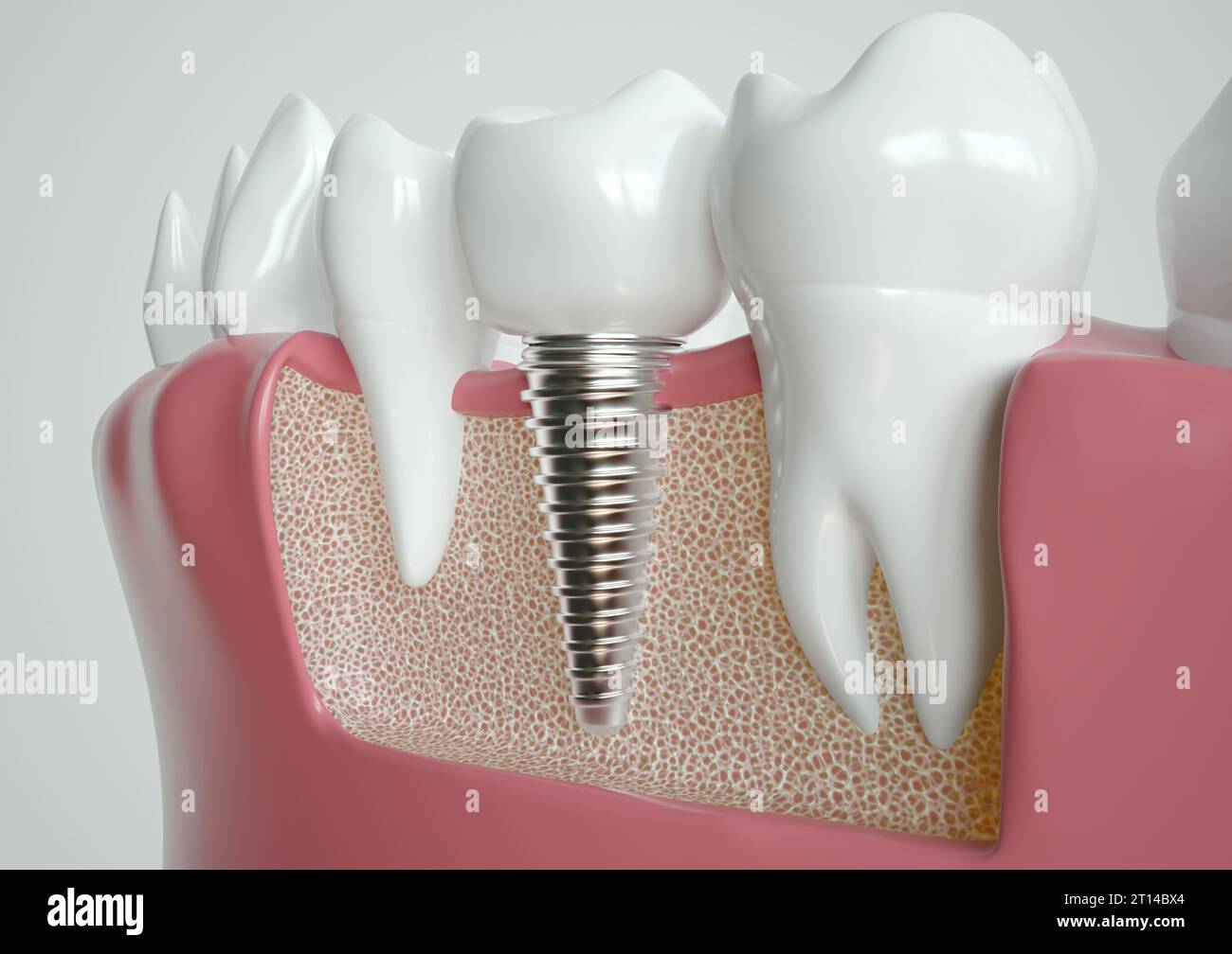 Pre visualization hi-res stock photography and images - Alamy