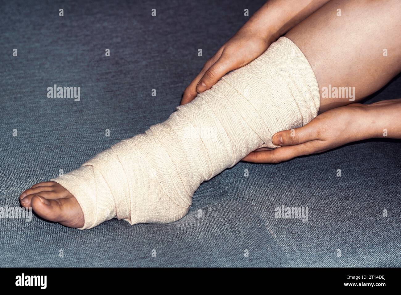 Woman with broken leg. female bandaging foot on the floor. The concept ...