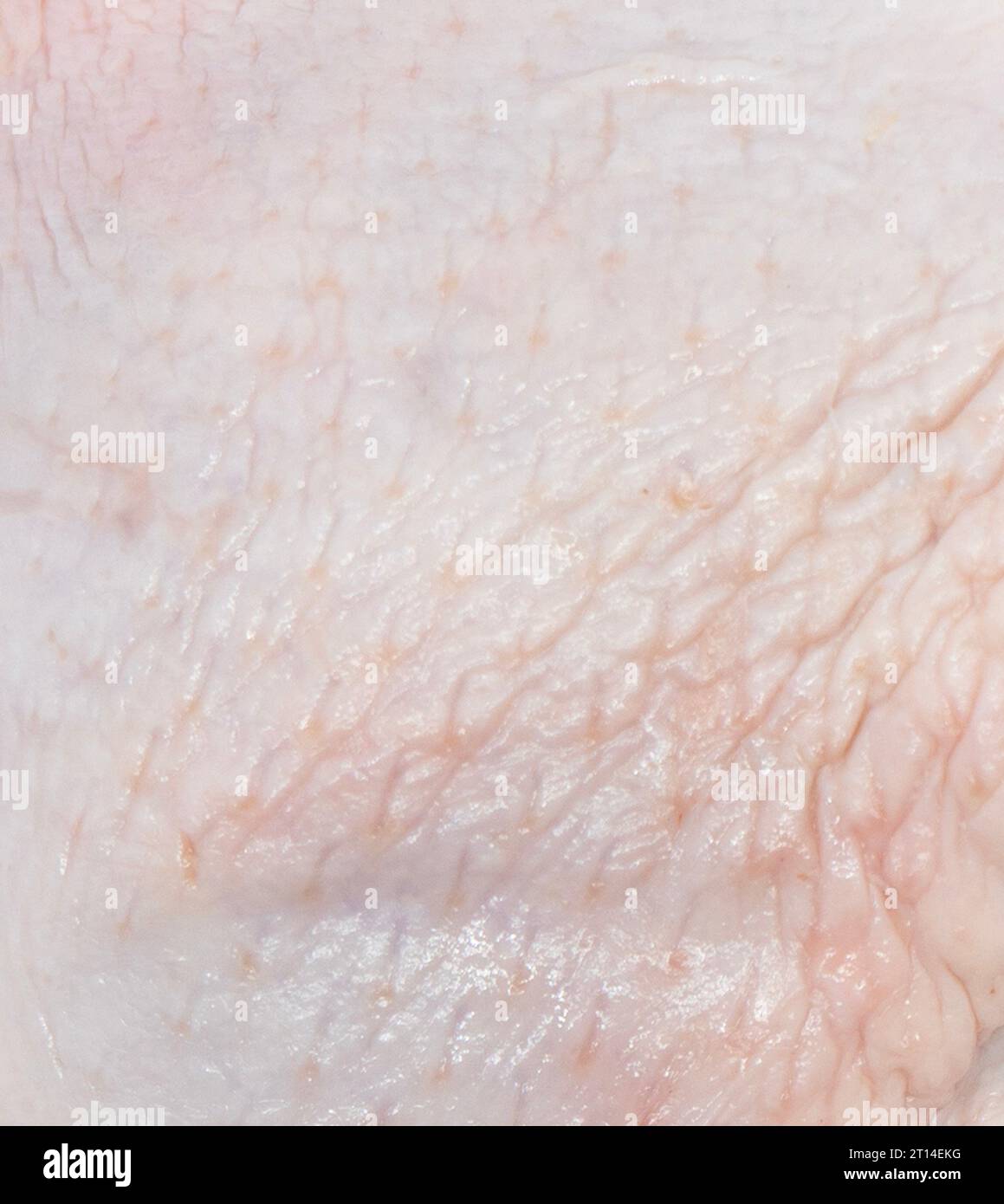 Chicken skin stexture background. Raw chicken surface pattern Stock ...