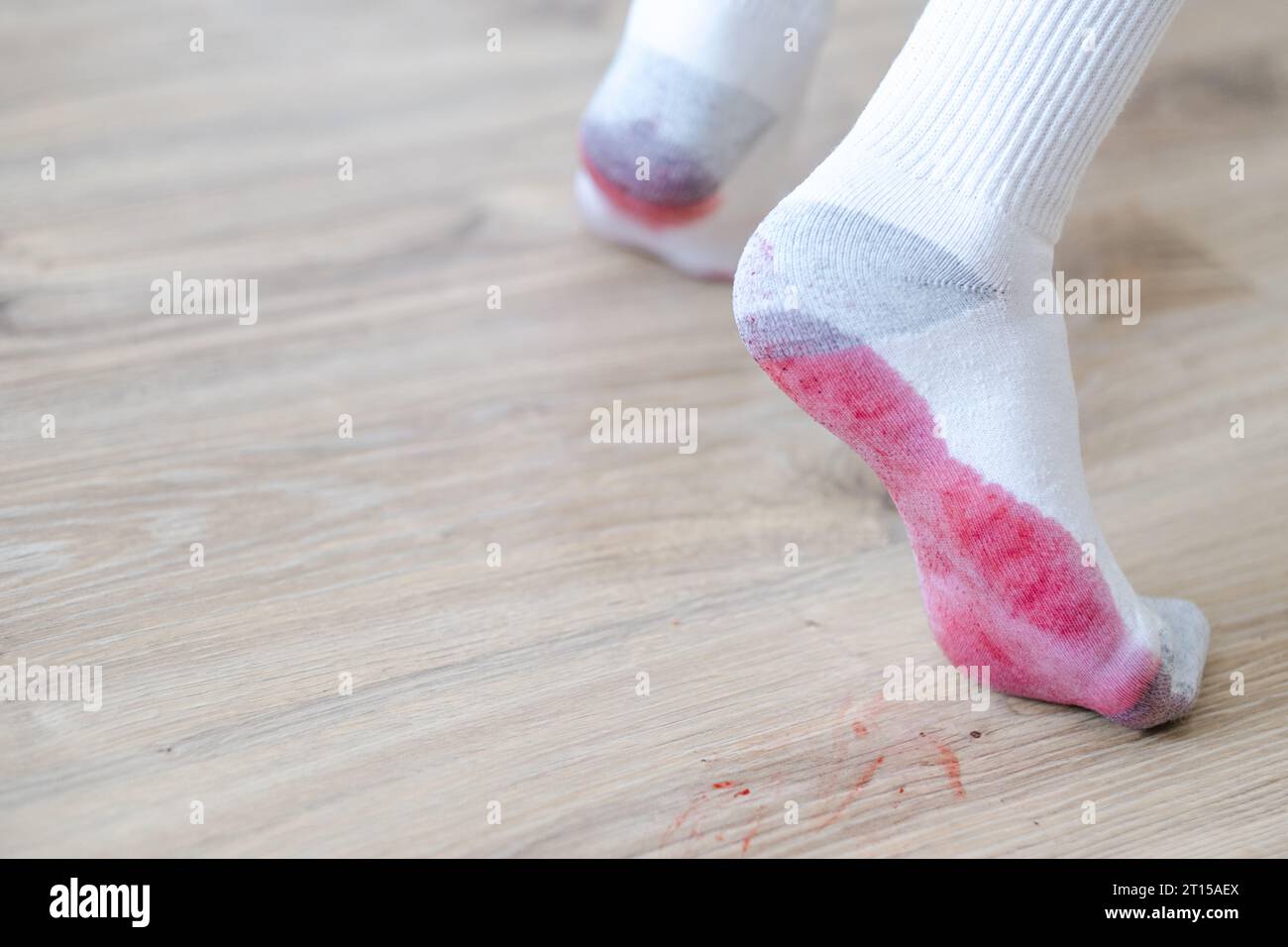 Dirty berries stains on white clothes. An unrecognizable person ...