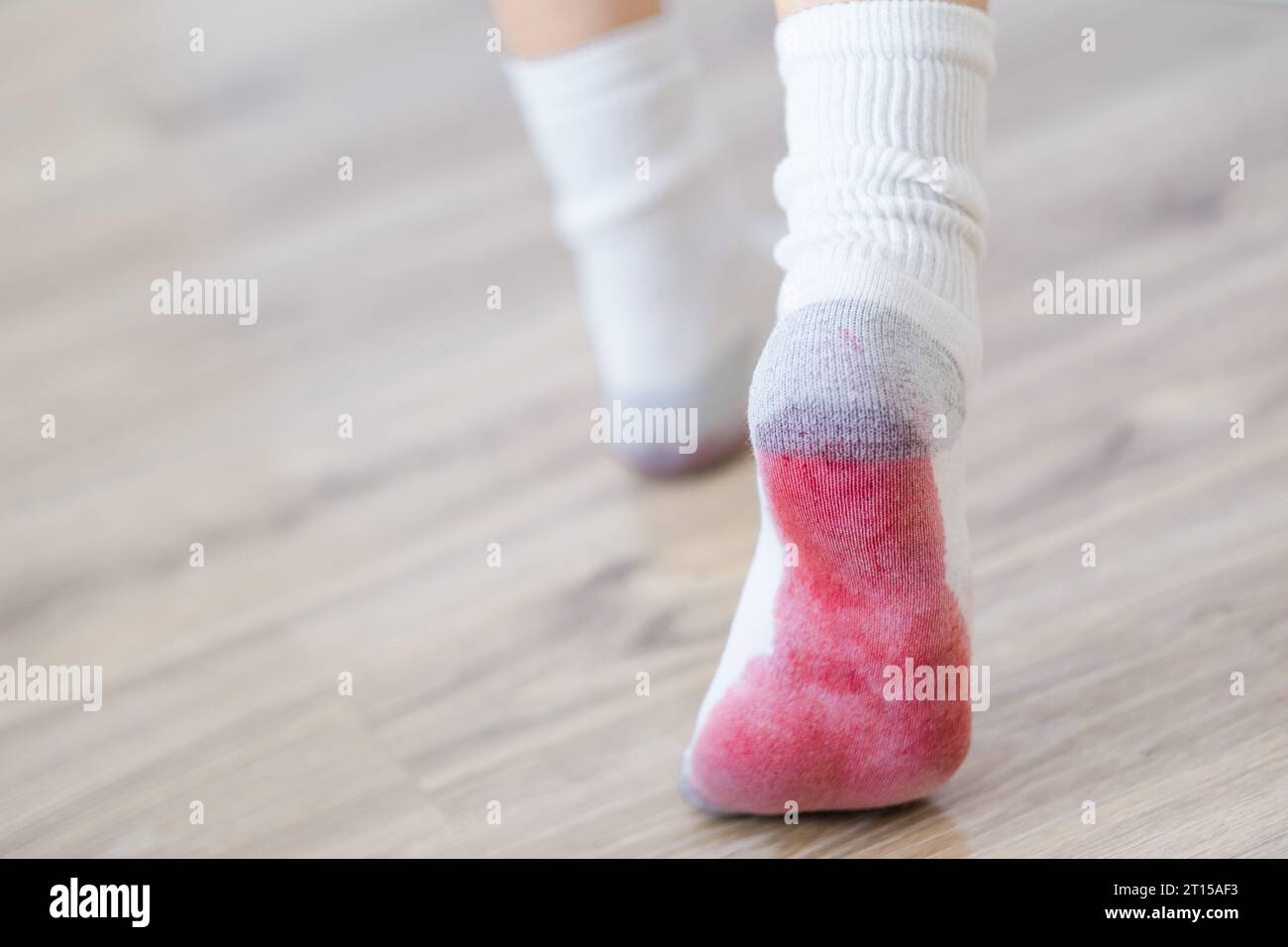 Dirty stains of spilled juice on white socks. daily life stain concept ...