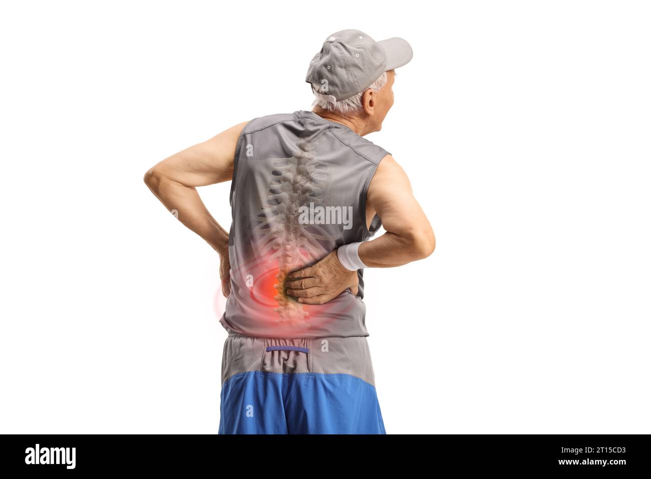 Lower arm bone hi-res stock photography and images - Alamy