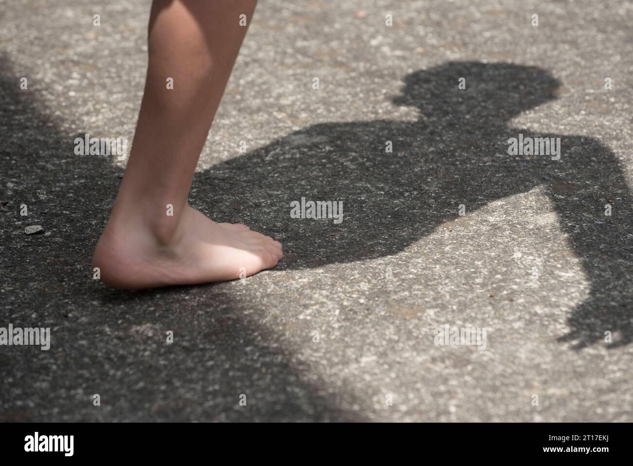 Foot Injury After An Accident, Injured Part Of The Body Foot Injury ...