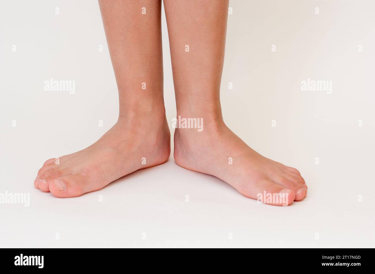 Cropped barefoot child legs Stock Photo - Alamy