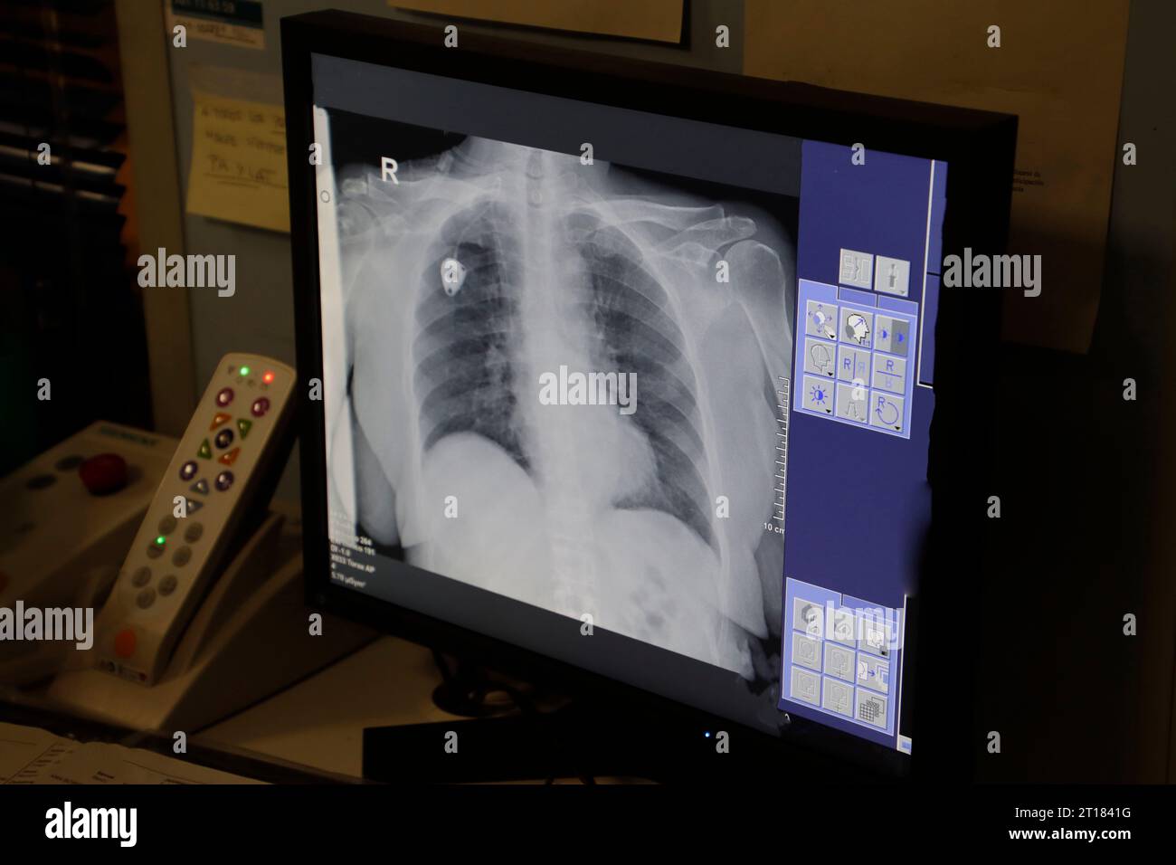 A modern radiology room with a black computer monitor with a diagnostic ...